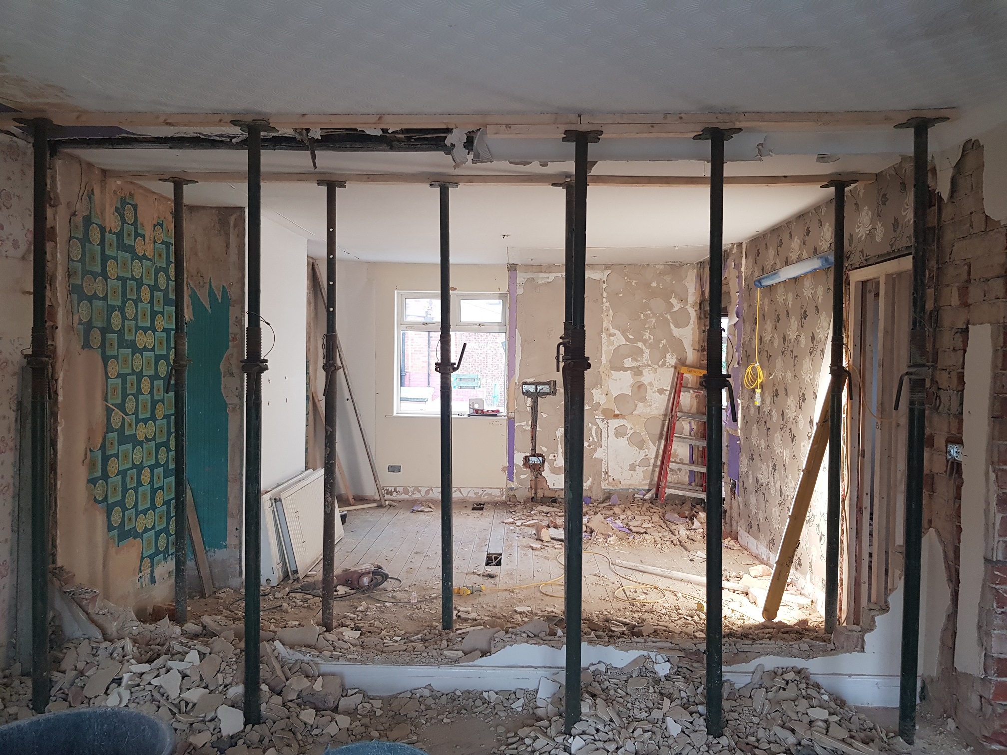 A full arch reconstruction and a practice reconstruction...