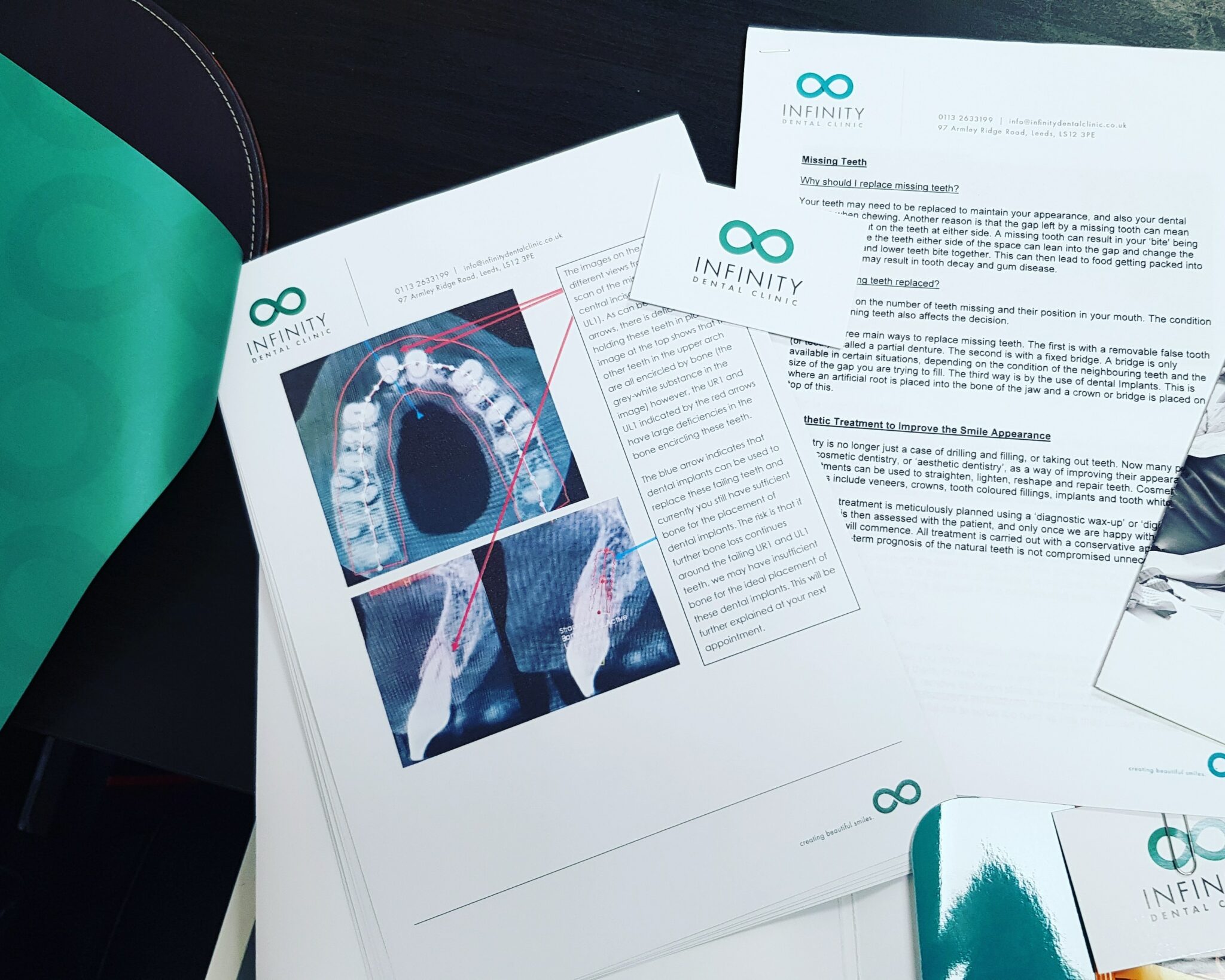 3 patients, 3 Dental Implant cases and 3 completely different procedures