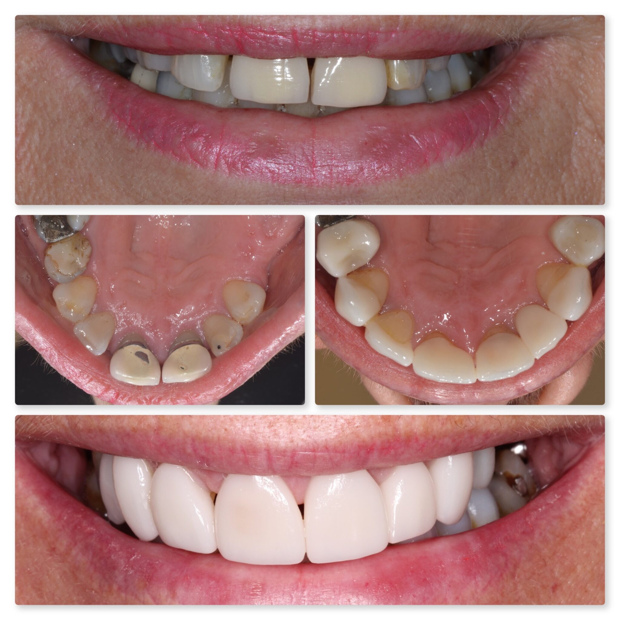 Putting up with 'bad' teeth - Are they really 'bad'? Can they be improved?