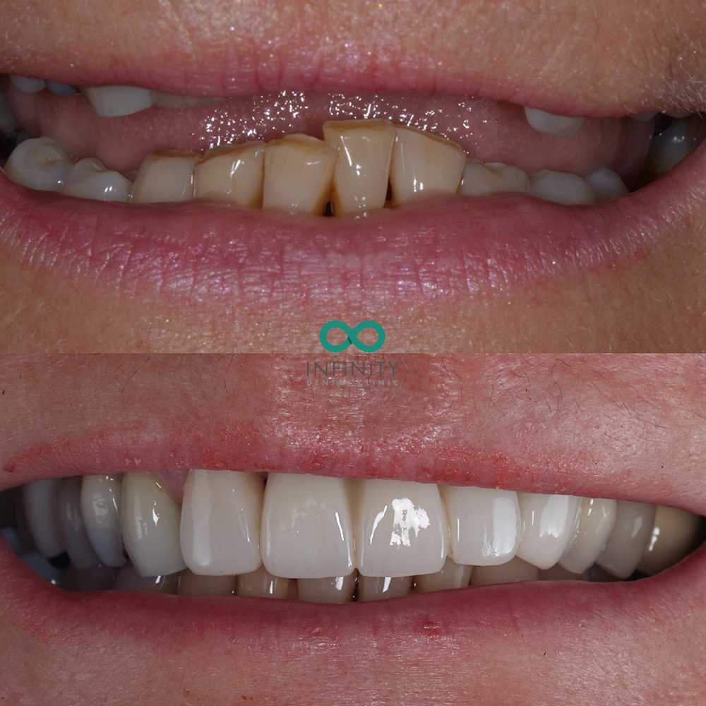 Transforming Smiles with Teamwork: A Tale of Two Dentists | Infinity ...