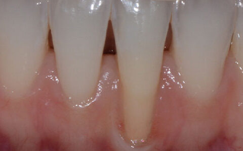 Infinity Dental Clinic | Dentist | Creating Beautiful Smiles